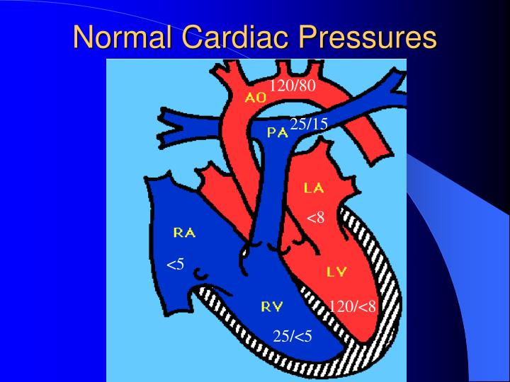 Ppt Pediatric Board Review 2013 Pediatric Cardiology Powerpoint