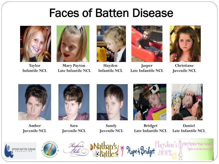 Ppt Batten Disease Powerpoint Presentation Id 1994829