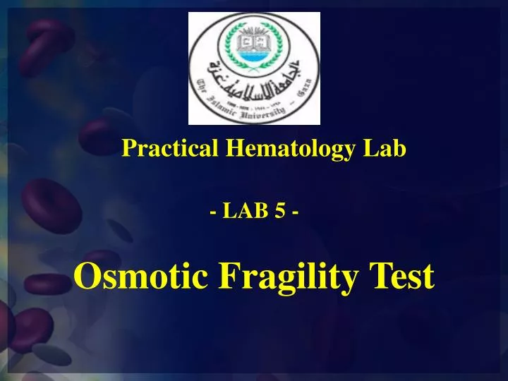 PPT - Osmotic Fragility Test PowerPoint Presentation - ID:2121803 PPT - Osmotic Fragility Test PowerPoint Presentation - ID:2121803