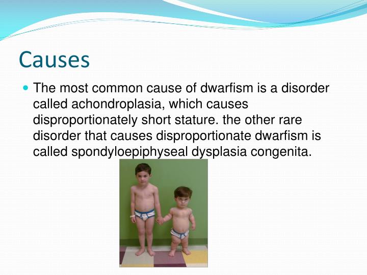 Ppt Dwarfism Powerpoint Presentation Id 2211221