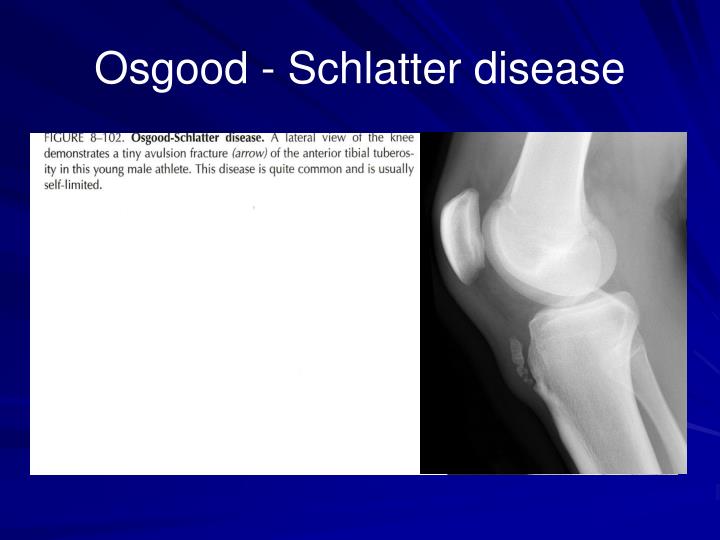 Ppt Lower Extremities Powerpoint Presentation Id 2255349