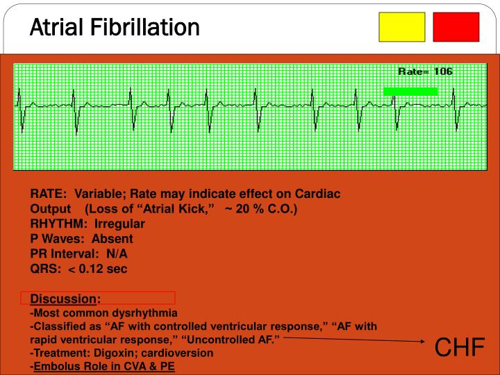 Controlled Vs Uncontrolled Atrial Fibrillation | My XXX Hot Girl Controlled Vs Uncontrolled Atrial Fibrillation | My XXX Hot Girl