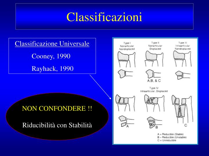PPT - Le fratture di polso PowerPoint Presentation - ID:3482223 PPT - Le fratture di polso PowerPoint Presentation - ID:3482223