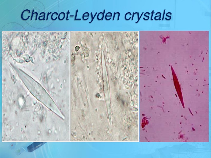 PPT - Medical Parasitology Lab PowerPoint Presentation - ID:1515700