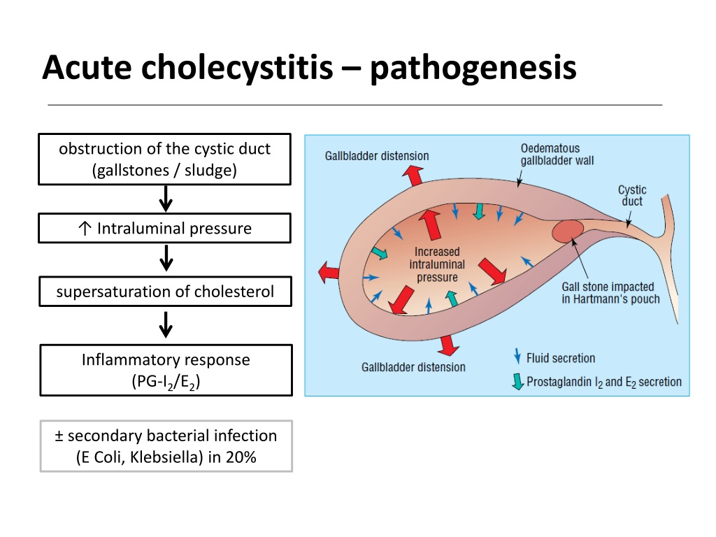 PPT - Biliary disease + pancreatitis for finals (and beyond) …the story ...