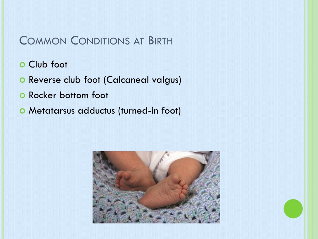 PPT - Kids’ Feet: Podopediatrics PowerPoint Presentation, free download ...