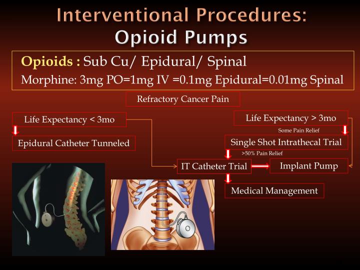 PPT - Interventional Pain Management For Cancer Patients PowerPoint ...