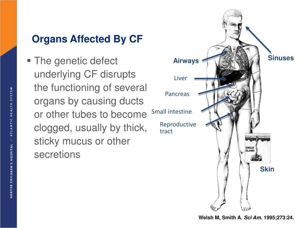 PPT - “I’m still breathing” Pediatric Pulmonary Board Review PowerPoint ...