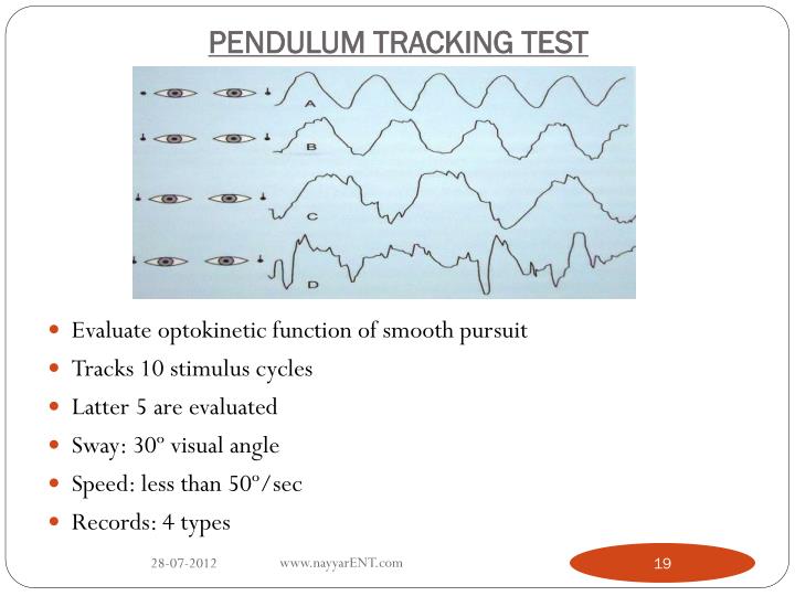 PPT - Electronystagmography PowerPoint Presentation - ID:1543155