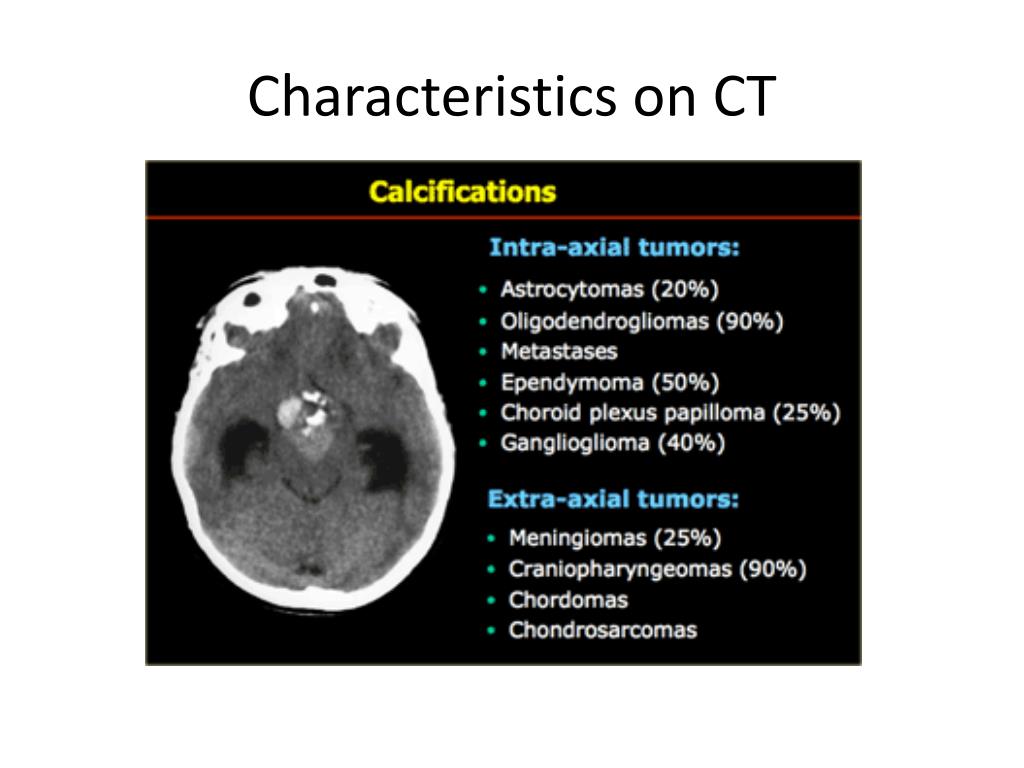 PPT - Diagnostic Imaging Approach to a Supratentorial SOL in an Adult ...