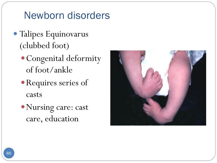 PPT - Maternal child health nursing PowerPoint Presentation - ID:1558487