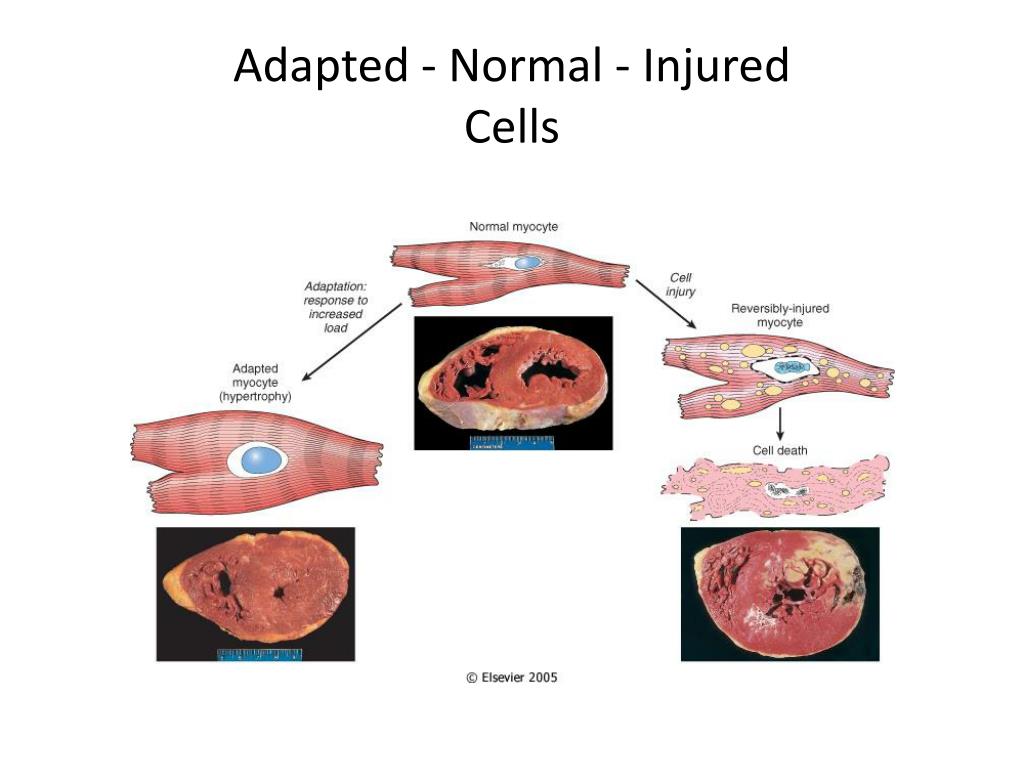 PPT - Cell Injury, Death, Inflammation, and Repair PowerPoint ...