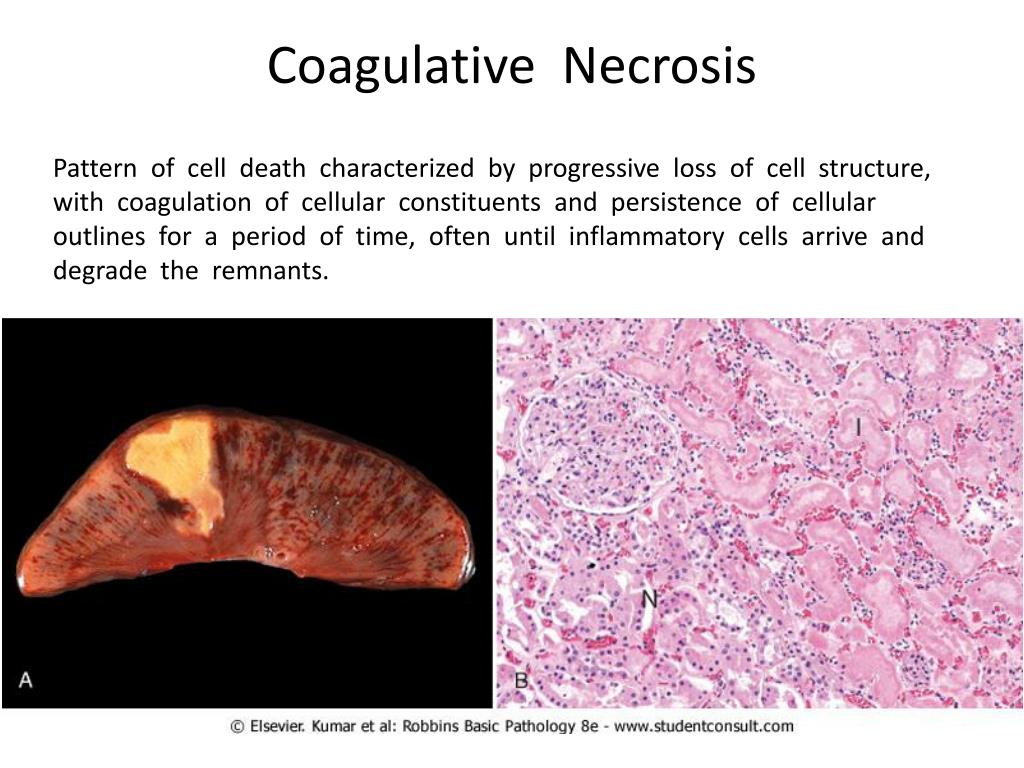PPT - Cell Injury, Death, Inflammation, and Repair PowerPoint ...