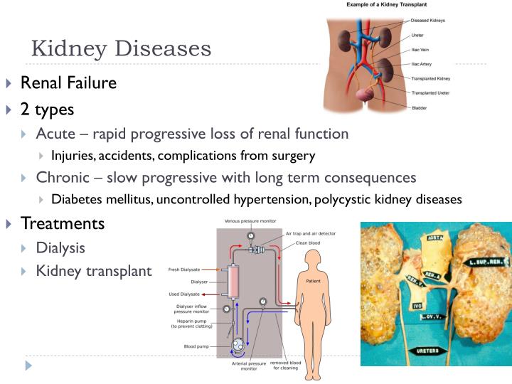 PPT - Homeostasis PowerPoint Presentation - ID:1562690