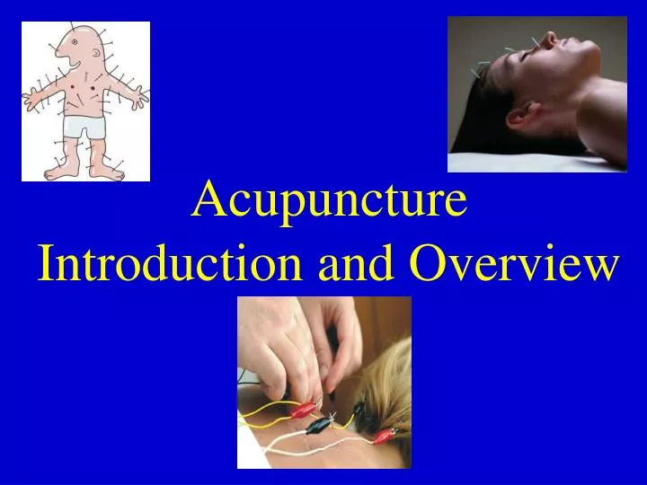PPT - Acupuncture Introduction and Overview PowerPoint Presentation ...