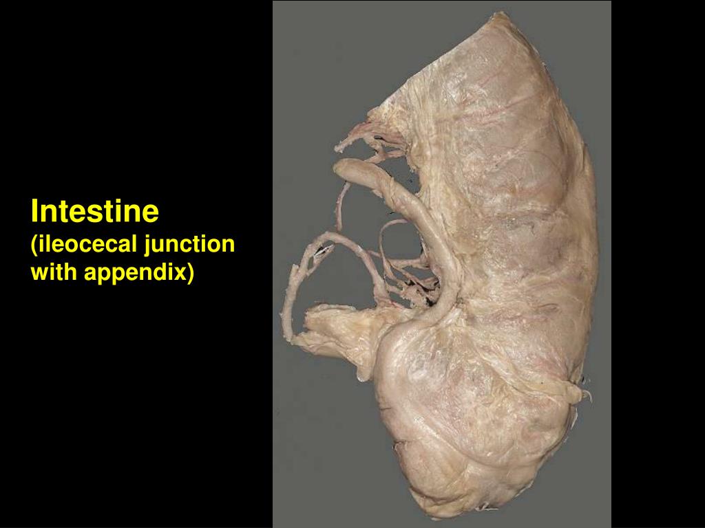 PPT - Use of Plastinated Human Cadavers in Anatomy & Physiology ...