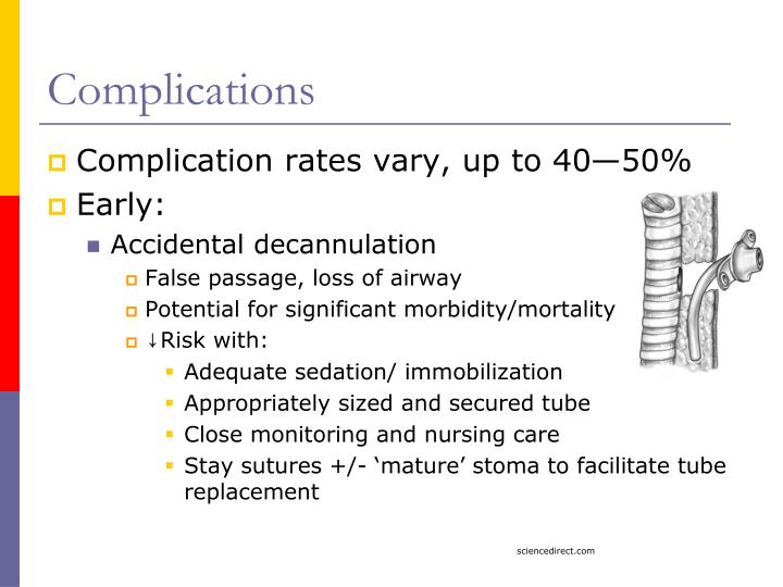 PPT - Pediatric Tracheostomy PowerPoint Presentation - ID:1567064