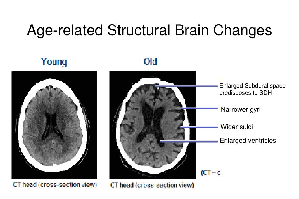 PPT - Clinical Aspects of Dementia: Emphasis on Alzheimer Disease ...