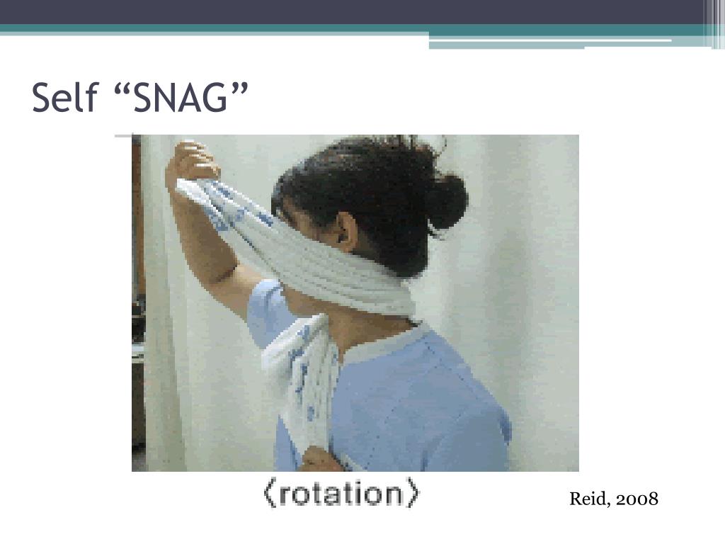 PPT - Cervicogenic Dizziness Differential Diagnosis & Treatment ...