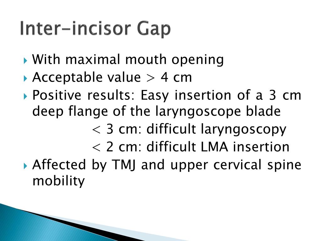 PPT - Anaesthetic management of patient with Maxillofacial injury ...