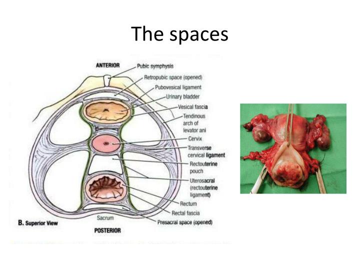 PPT - Pelvic Surgical Anatomy PowerPoint Presentation - ID:1568122