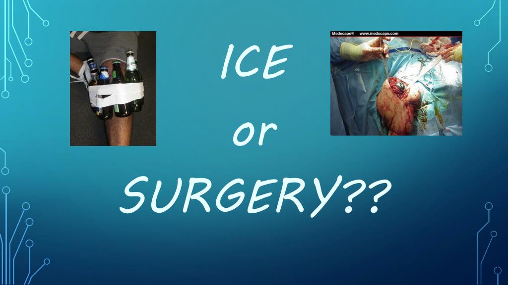 PPT - Clinical Management of acute orthopedic injuries PowerPoint ...