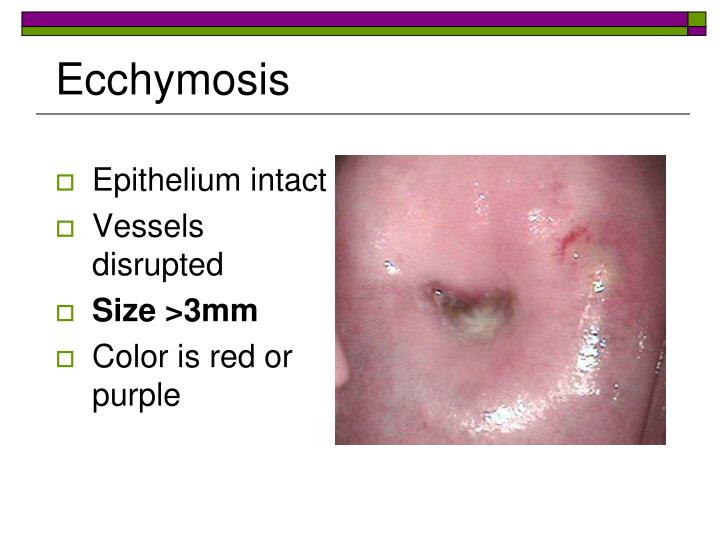 PPT - Clinical Considerations PowerPoint Presentation - ID:1569779