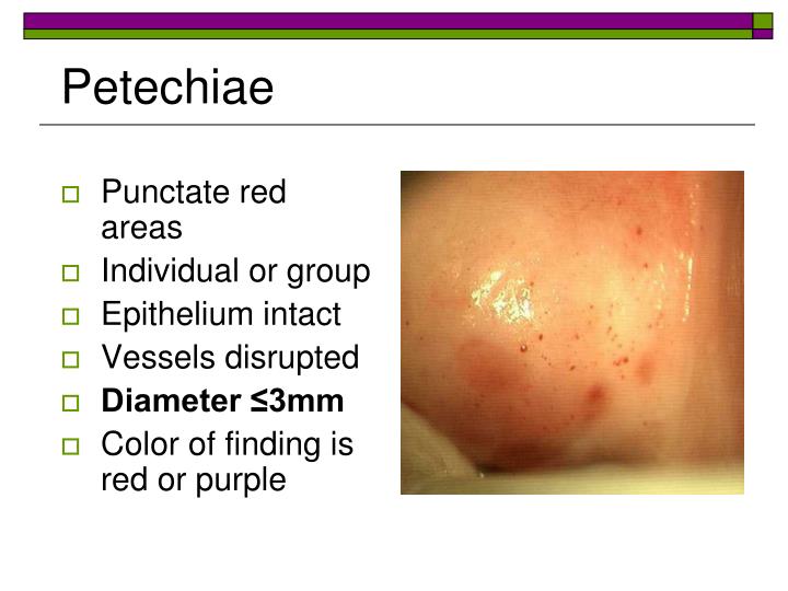 PPT - Clinical Considerations PowerPoint Presentation - ID:1569779