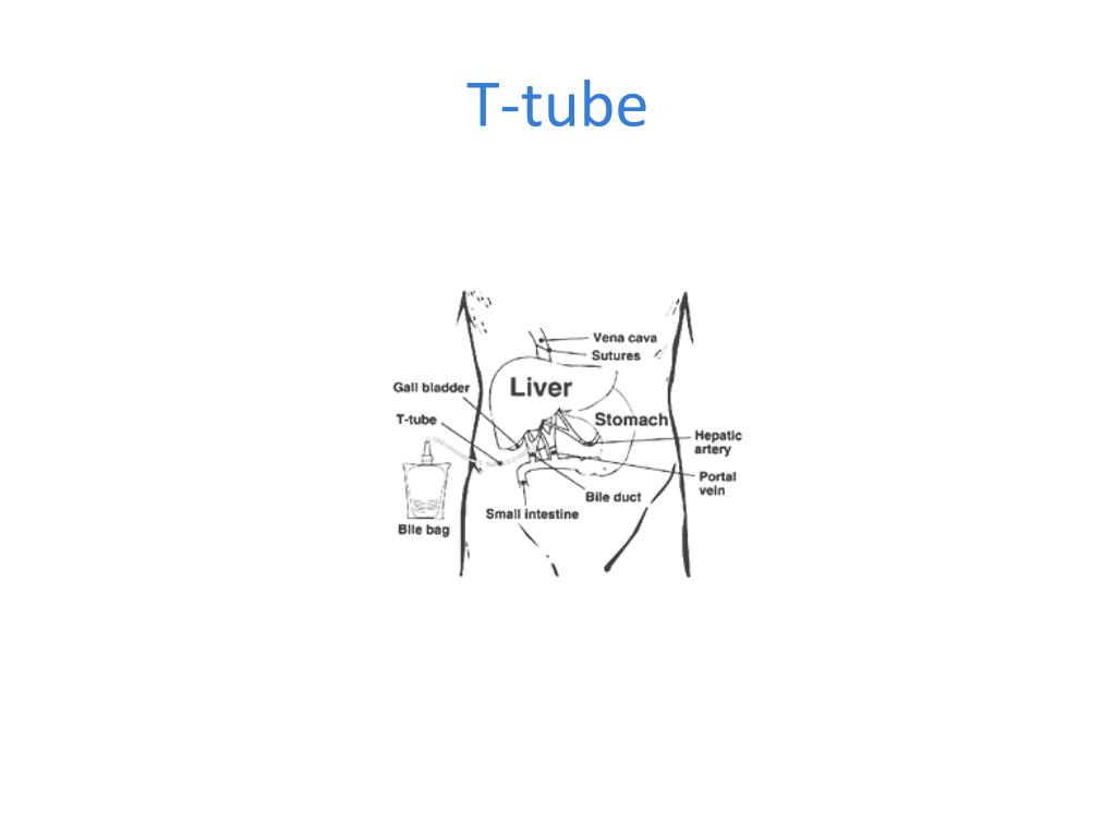 PPT - Nursing Care of Patients with Hepatobiliary Disorders PowerPoint ...