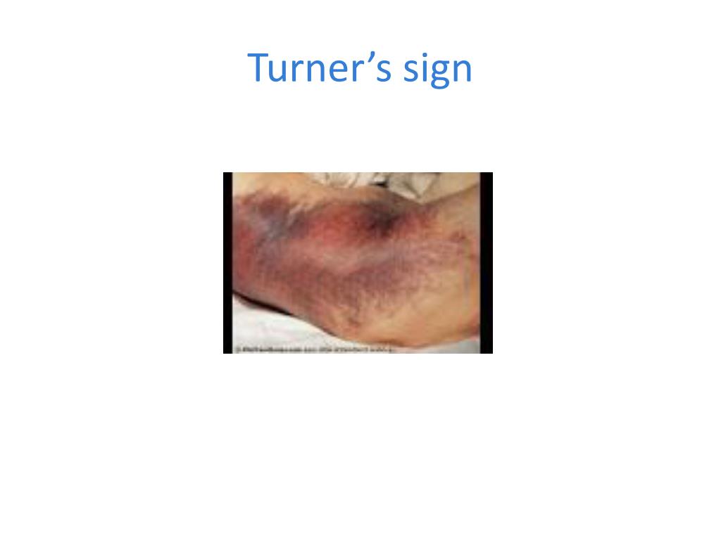 PPT - Nursing Care of Patients with Hepatobiliary Disorders PowerPoint ...