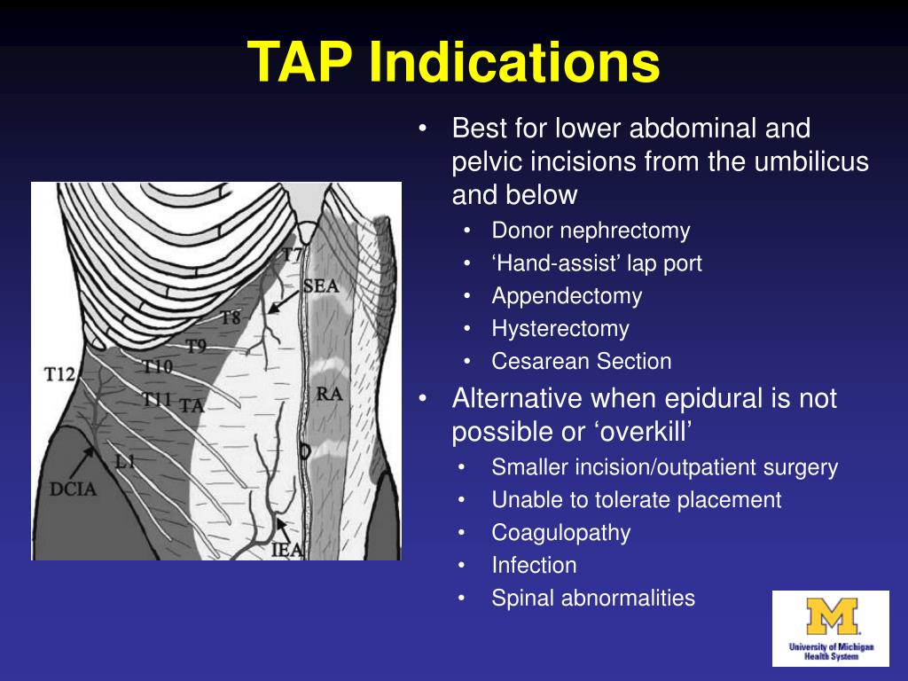 PPT - What’s New I n Acute Pain Management: Reducing Our Dependence O n ...