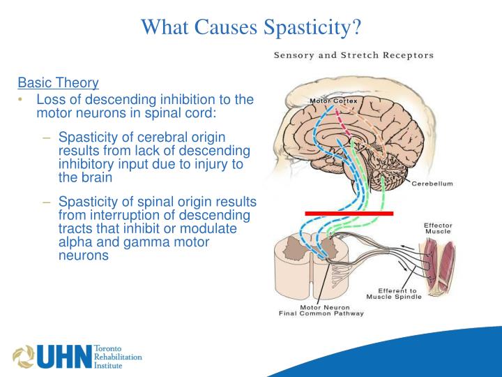 PPT - Spasticity and the Use of the Baclofen Pump for the SCI Patient ...
