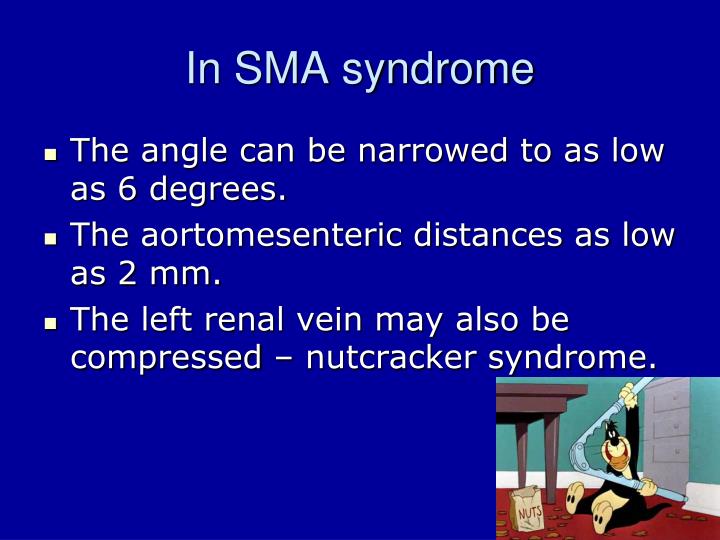 PPT - Superior Mesenteric Artery (SMA) Syndrome PowerPoint Presentation ...