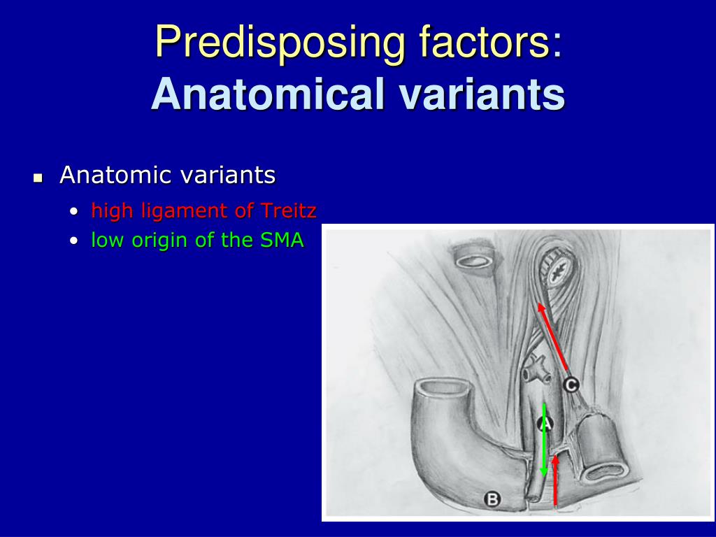 PPT - Superior Mesenteric Artery (SMA) Syndrome PowerPoint Presentation ...