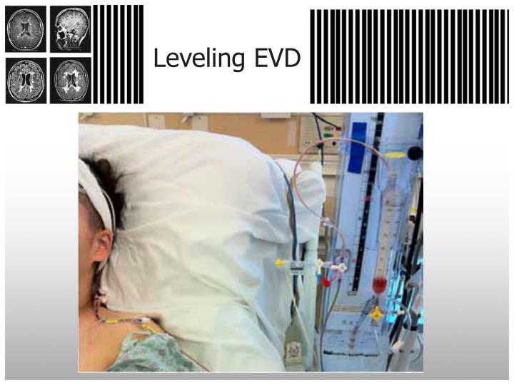 PPT - Care of the Patient with an EVD or Lumbar Drain PowerPoint ...