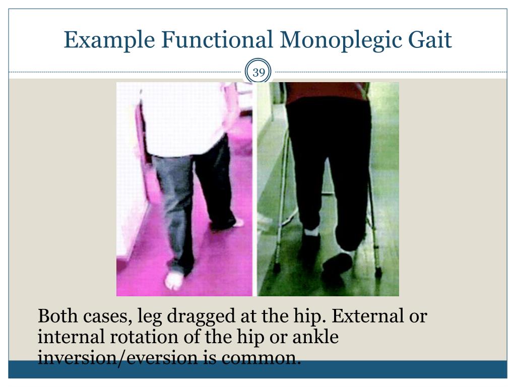 PPT - Psychiatric Aspects of Movement Disorders for Nurse Practitioners ...