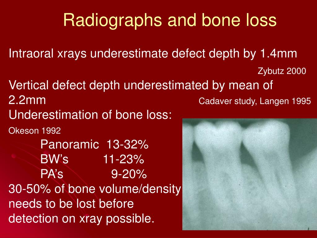 PPT - Periodontal Diagnoses and Treatment Planning PowerPoint ...