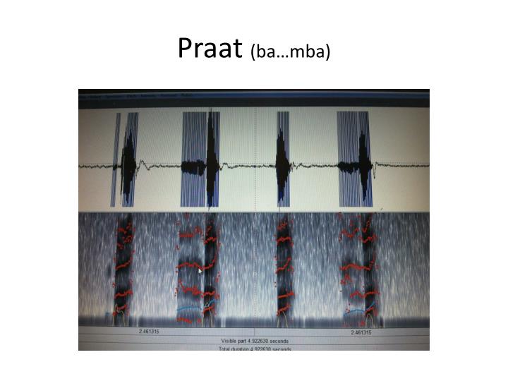 PPT - Cleft Palate Speech-Part 2: Assessment, Intervention and Medical ...
