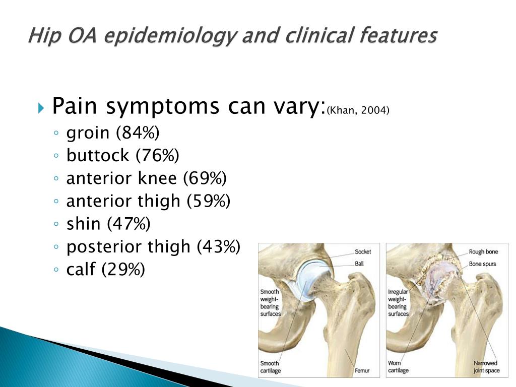 PPT - Diagnosing Leg Pain Lumbar Spinal Stenosis vs Hip Osteoarthritis ...