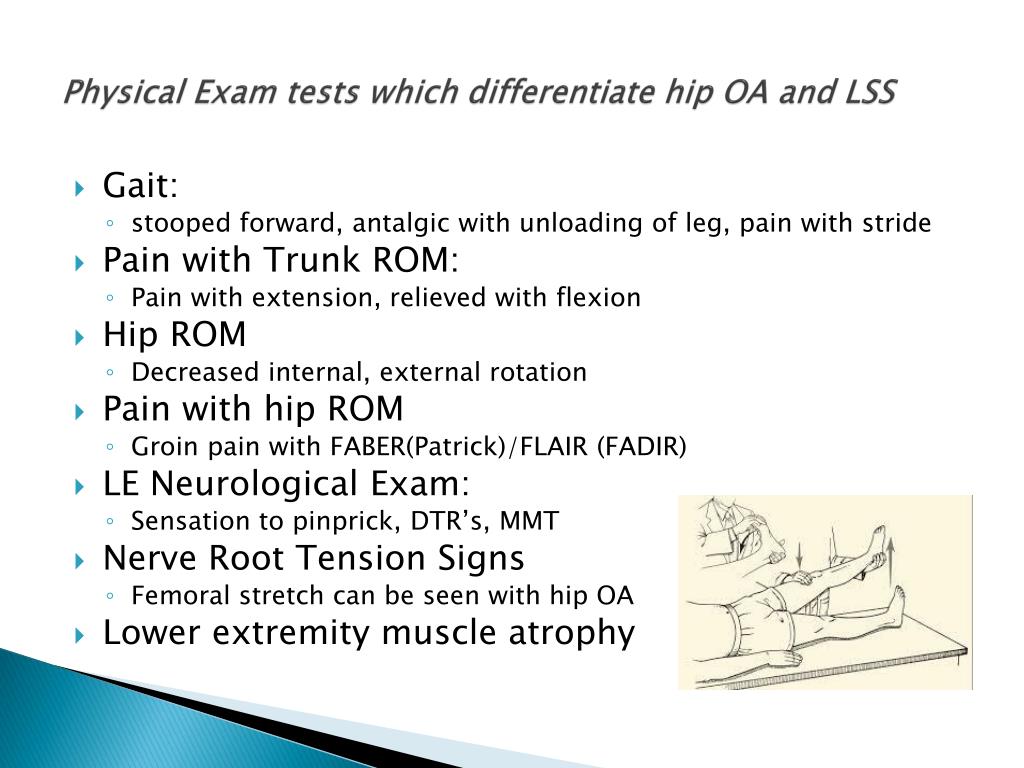 PPT - Diagnosing Leg Pain Lumbar Spinal Stenosis vs Hip Osteoarthritis ...