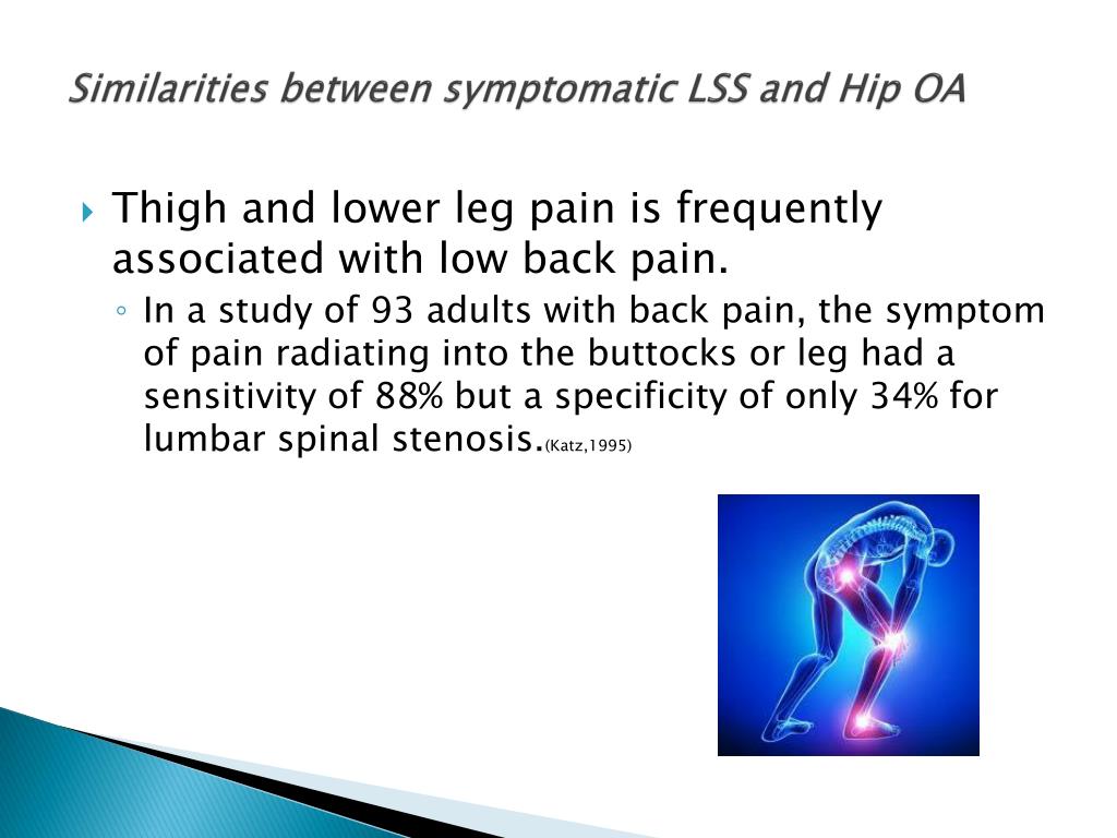 PPT - Diagnosing Leg Pain Lumbar Spinal Stenosis vs Hip Osteoarthritis ...