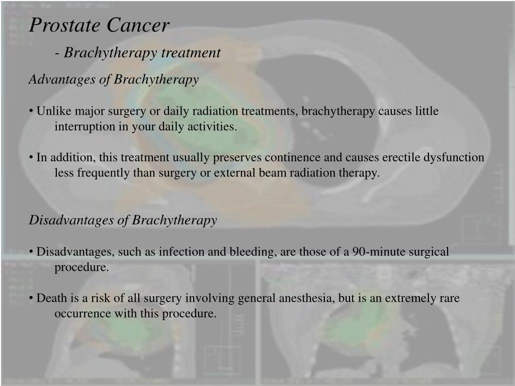 PPT - Radiation Safety, Brachytherapy & Proton Therapy for the ...