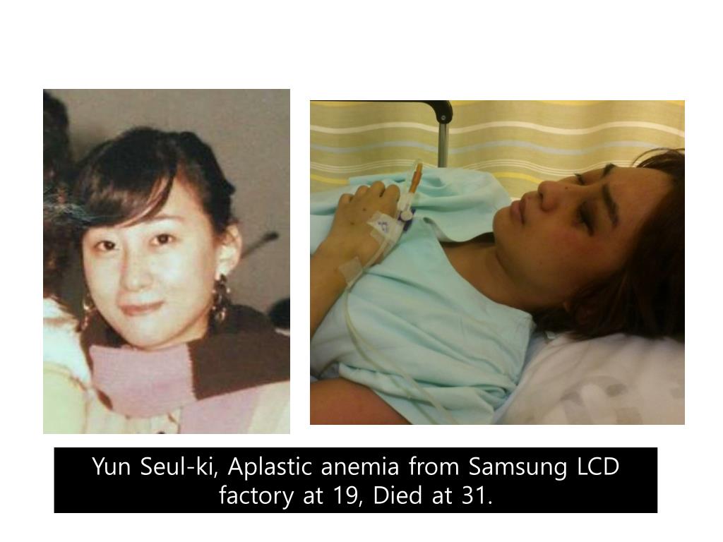 PPT - Yumi Hwang(1985~2007. Leukemia from Samsung semiconductor factory ...