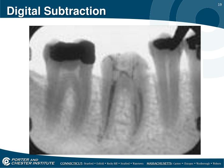 PPT - DIGITAL RADIOGRAPHY PowerPoint Presentation - ID:1587992