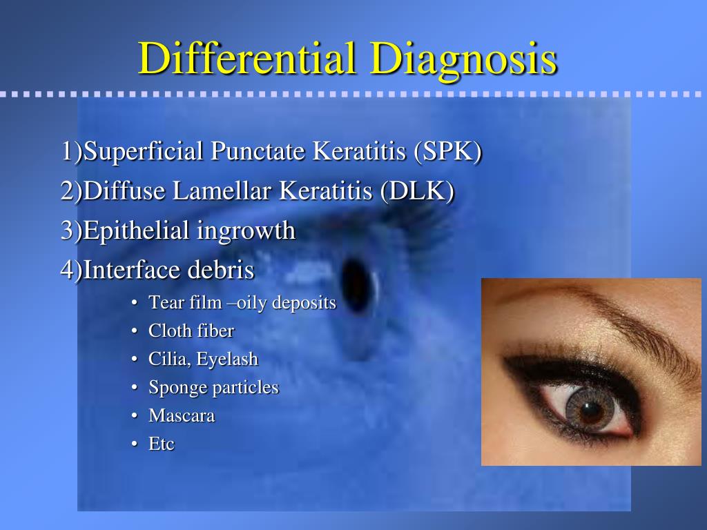 PPT - LASIK & PRK: Potential Post-op Corneal Opacities PowerPoint ...