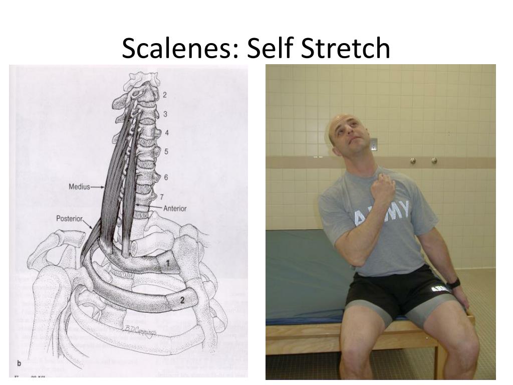 PPT - Muscle Imbalance Evaluation and Treatment of the Neck, Upper Back ...