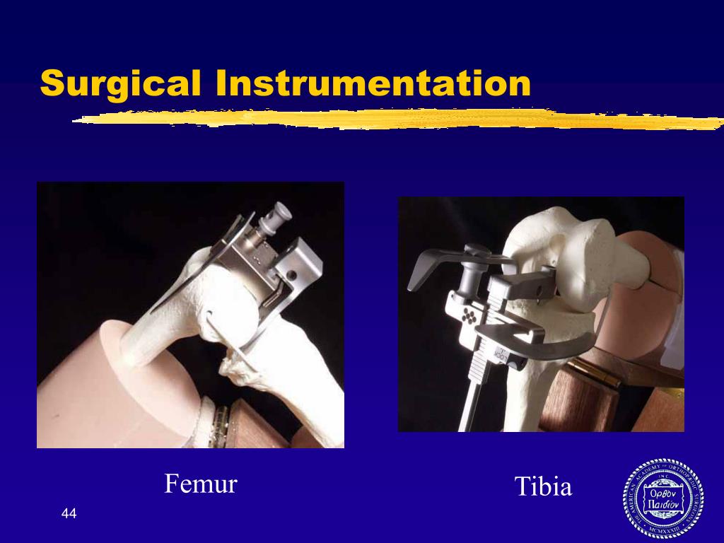 PPT - Arthritis Seminar Solutions for Knee, Shoulder and Hip PowerPoint ...