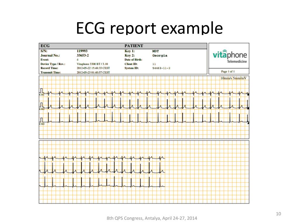 PPT - e-Health/m-Health applications for telemonitoring of outpatients ...