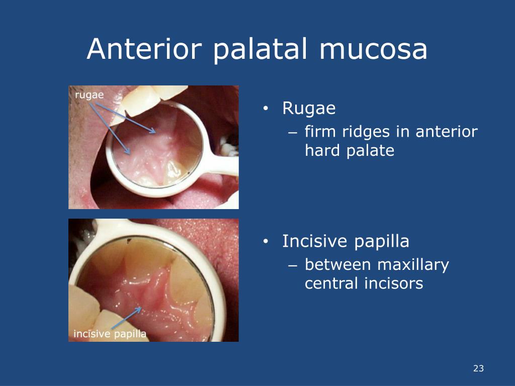 PPT - David Reznik , DDS Oral Examinations for Non-Dental Clinicians ...