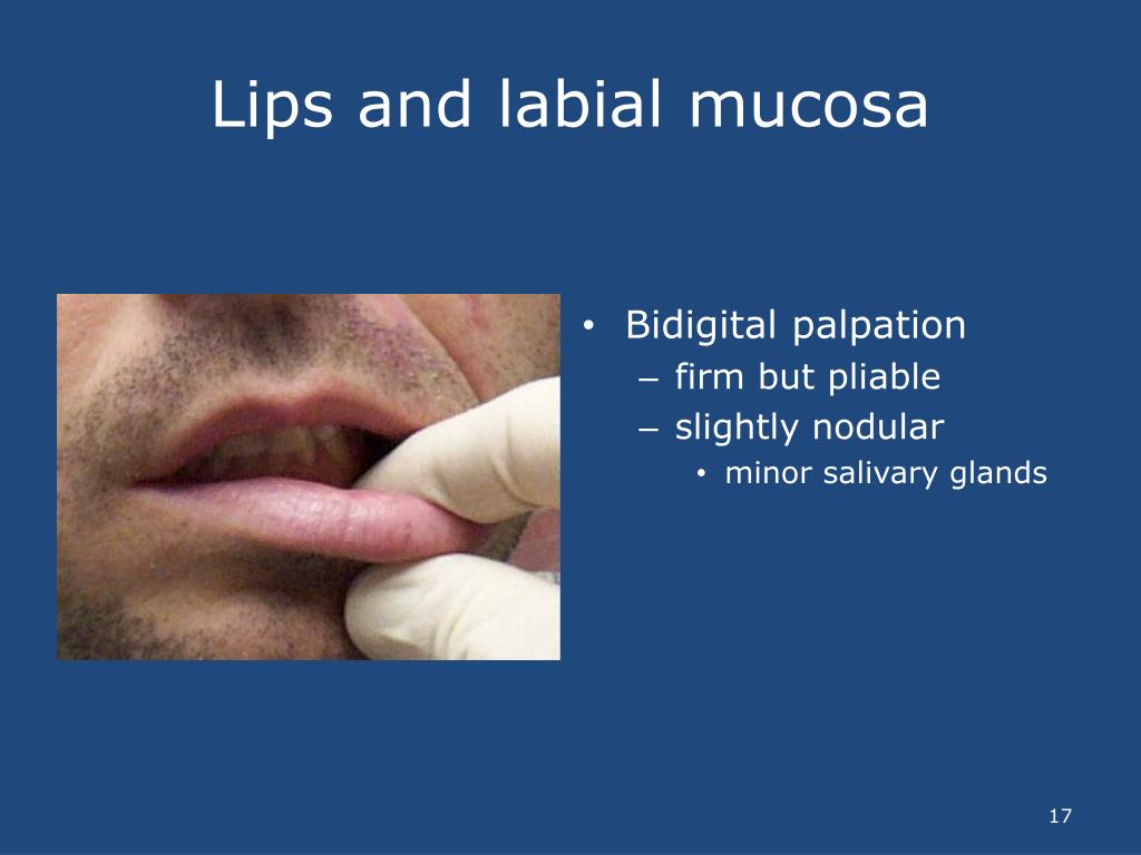 PPT - David Reznik , DDS Oral Examinations for Non-Dental Clinicians ...